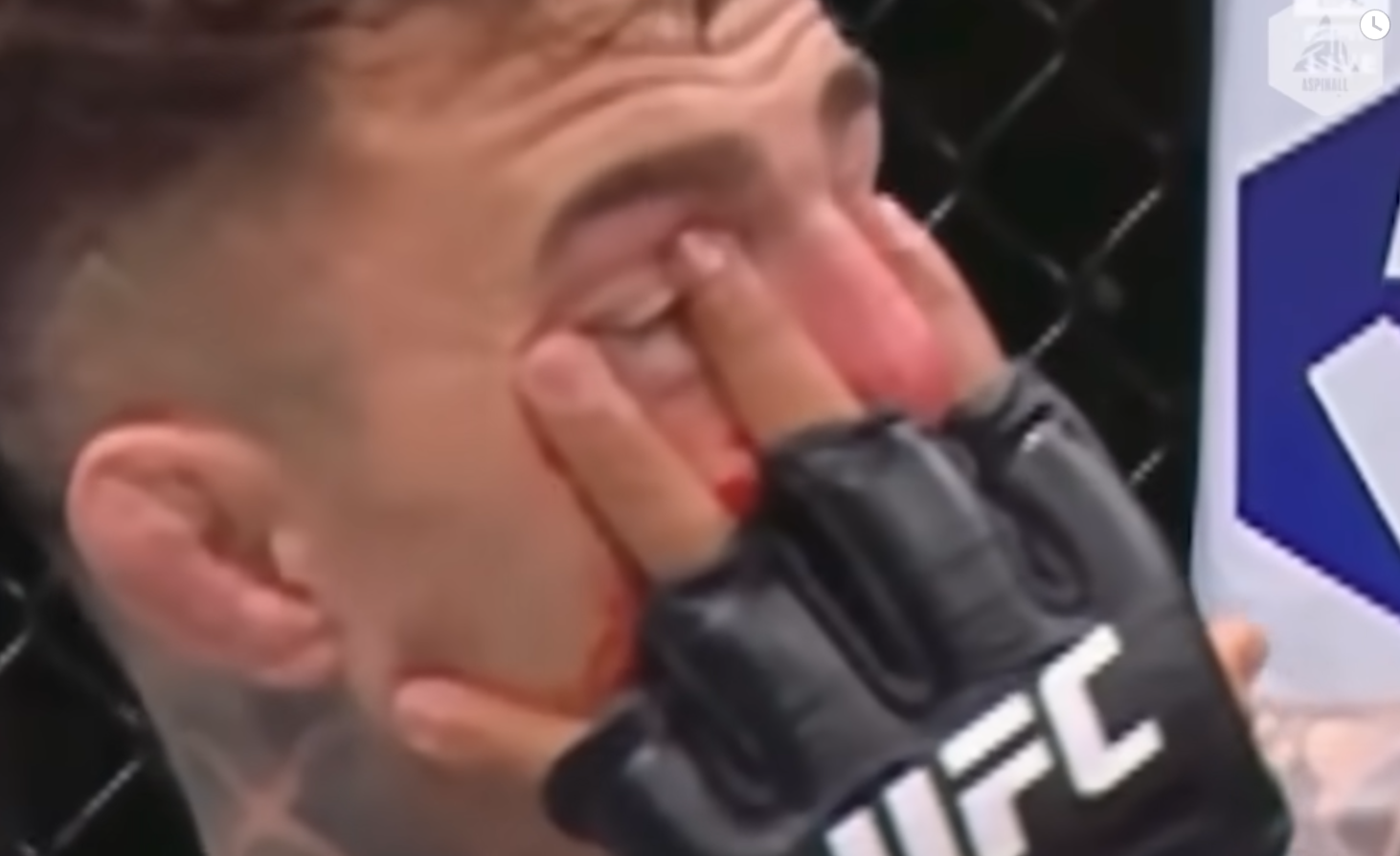 "It's a dangerous sport" - Eye-gouging ends Salford-born heavyweight ...